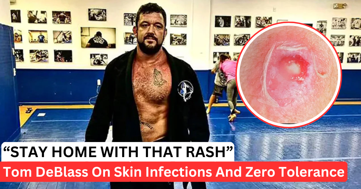 “Train With A Rash And You’re Selfish”: Tom DeBlass On Skin Infections ...